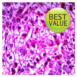 Human Pathology Prepared Slide Set